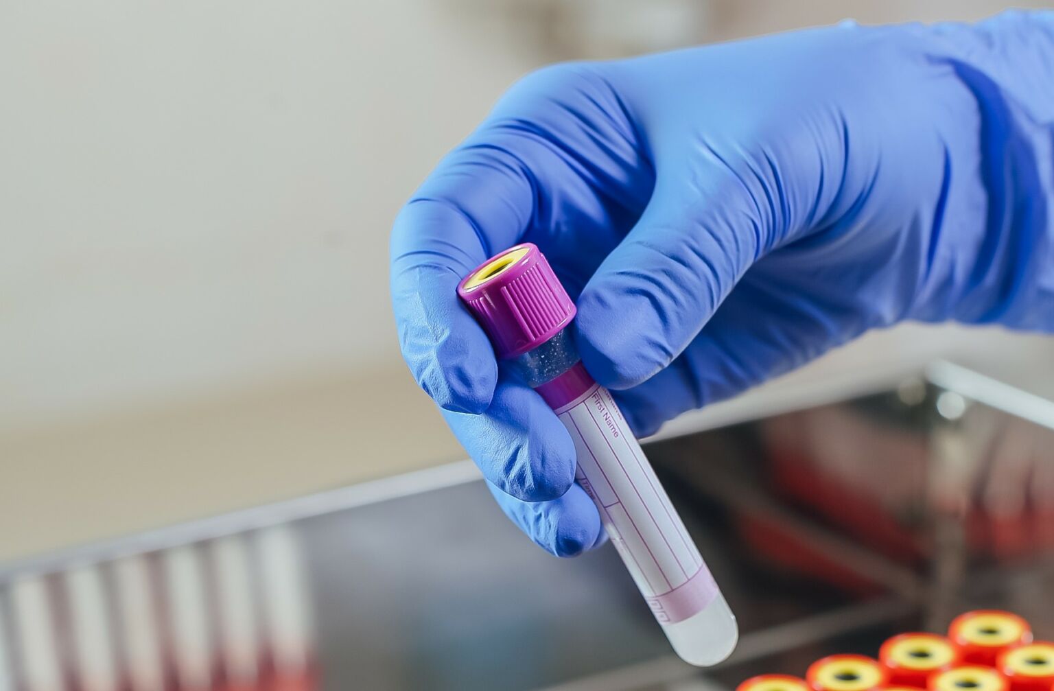 The Paulsen Lab – DEPARTMENT OF NEUROLOGY – UW–Madison